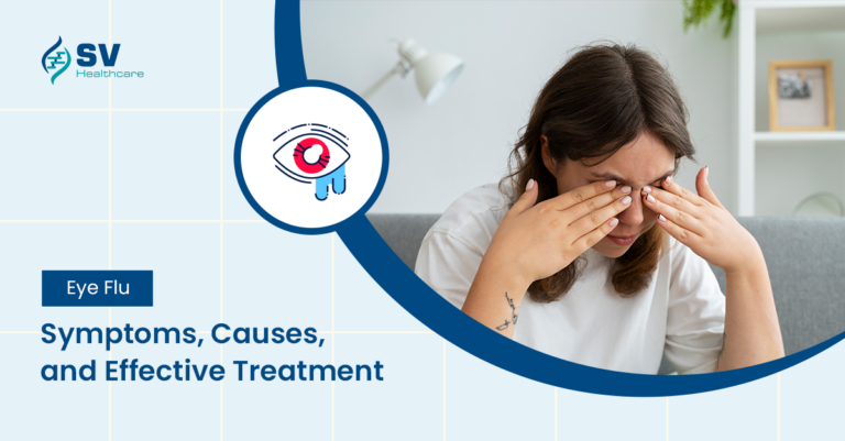Eye Flu: Symptoms, Causes, and Effective Treatment in 2024 - S V Healthcare